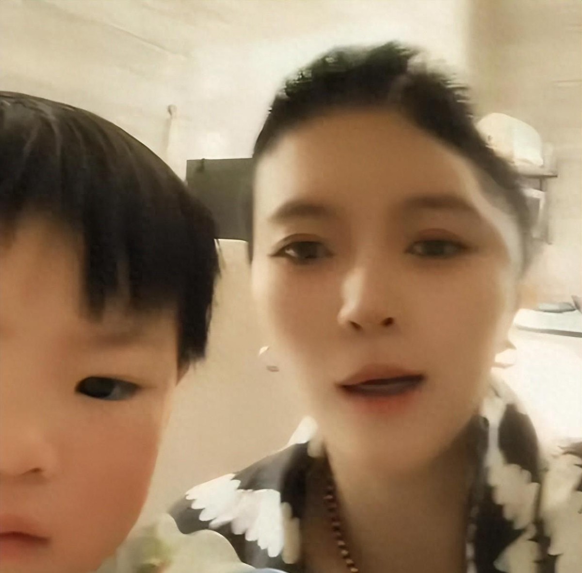 Singer Bi Xia shared her recovery progress. It looked like half of her ...