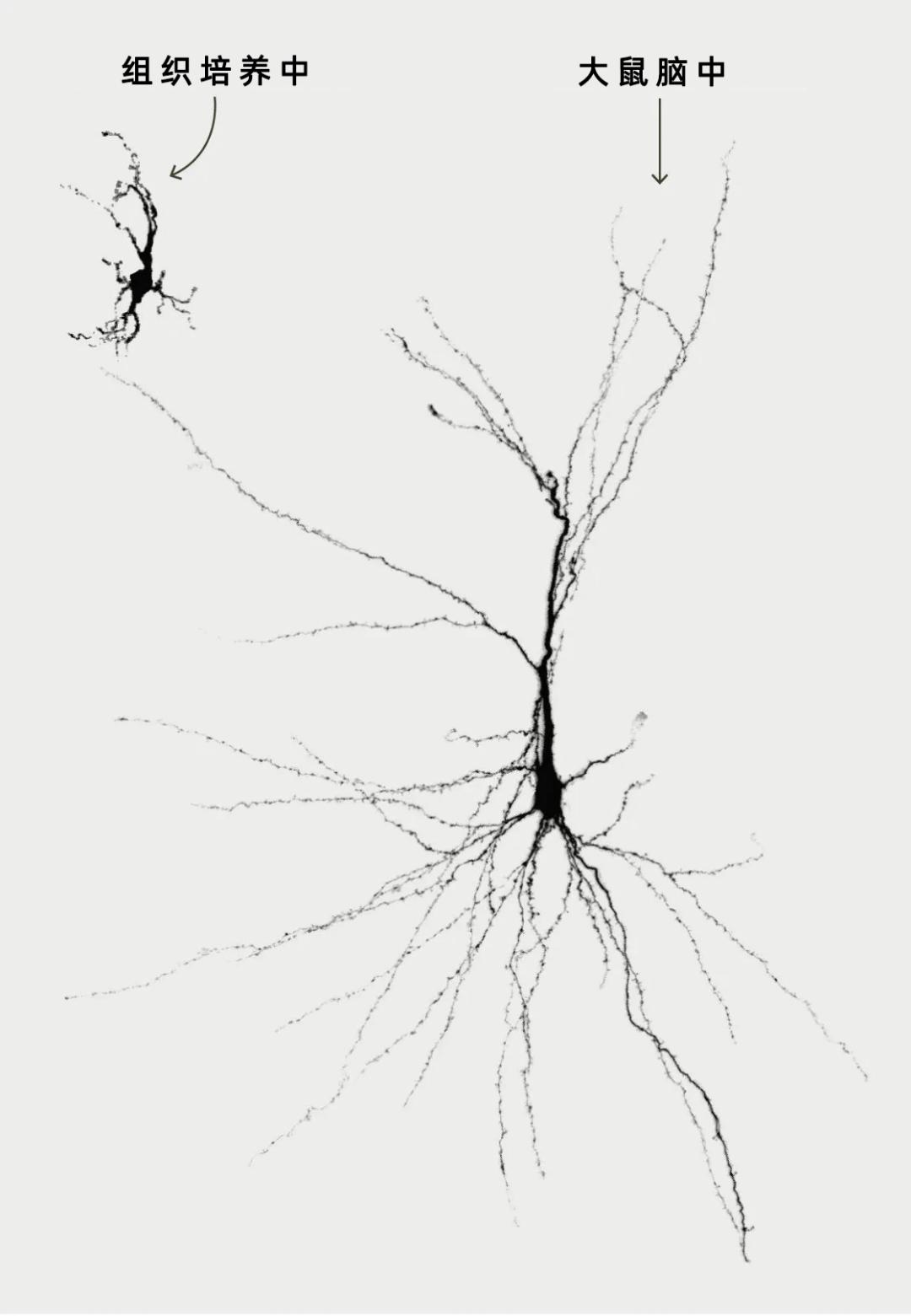 Implanting human brains into rat brains - iNEWS