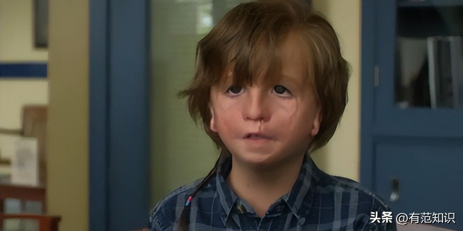 Self-esteem and self-confidence: Auggie's self-acceptance and growth in ...
