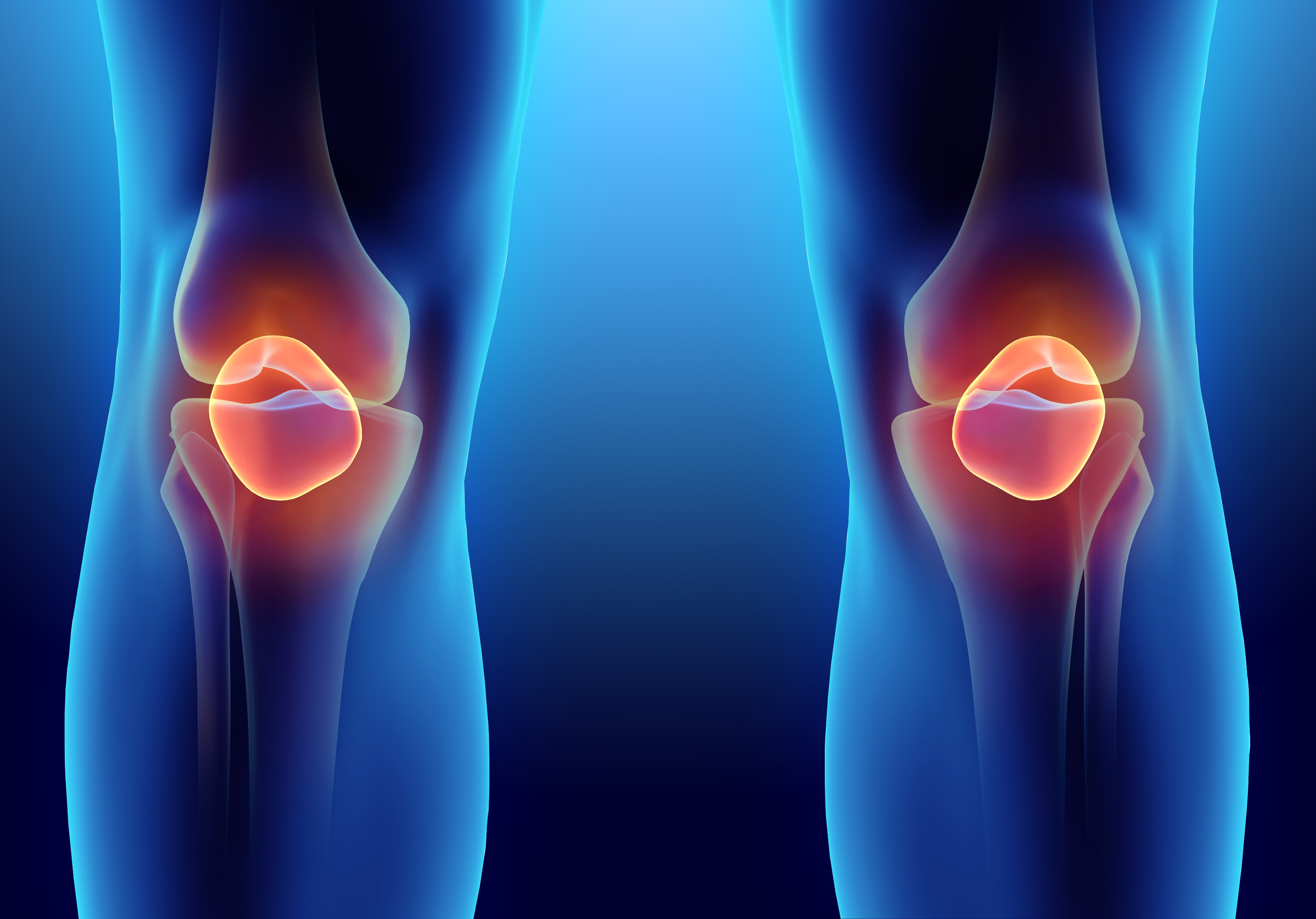 Diagnosis and treatment of knee joint infection after anterior cruciate ...