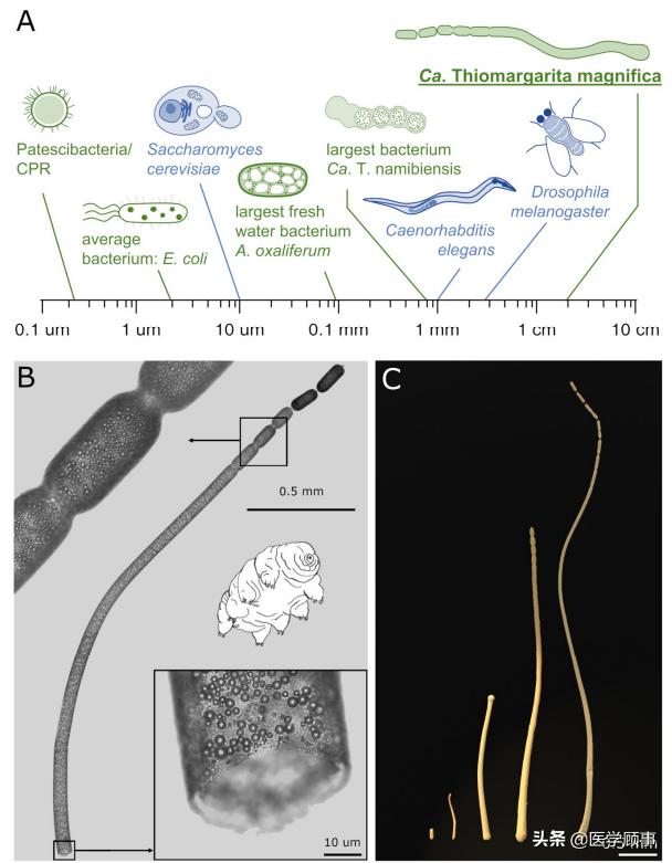 The world's largest giant bacteria with a body length of 2 cm has ...