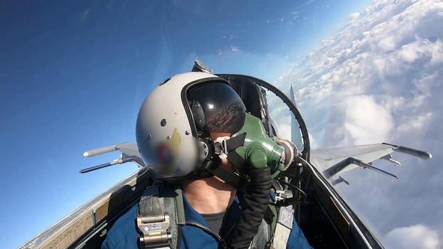 Can't be a pilot with scars, but a seriously injured pilot can continue ...