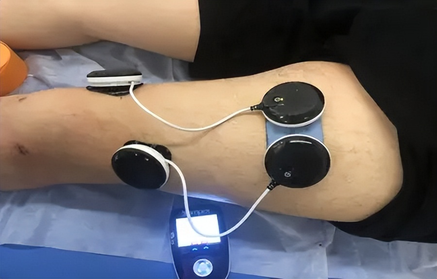 Compex auxiliary muscle training sharing after rear fork - iNEWS