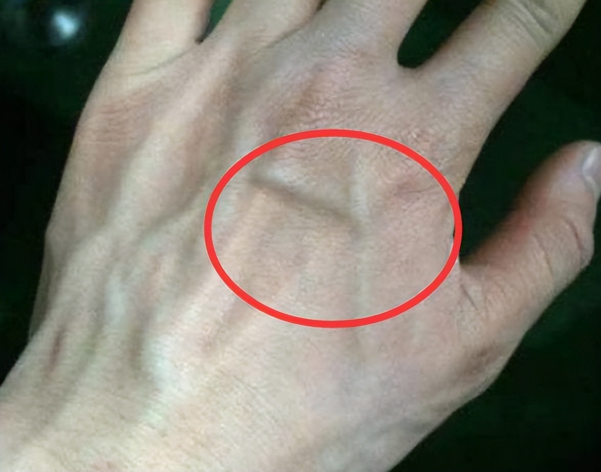 Why some people have "blue veins bursting out" on their arms, but some ...