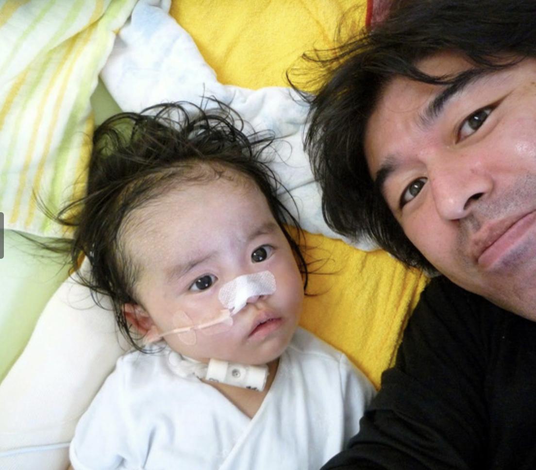 A child of one year and eight months in Japan suffers from a brain ...