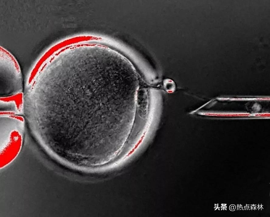 Is Japan's "human-animal embryo hybridization experiment" an innovation ...