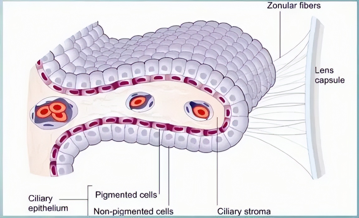 Research progress of glaucoma surgery based on ciliary process - iMedia