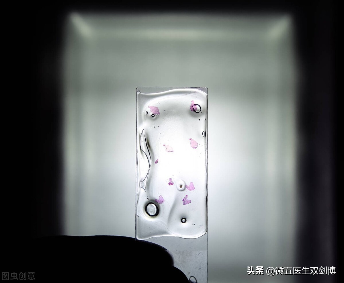 Hong Kong artist Zhu Wenjun died of lung cancer, the pain of advanced ...