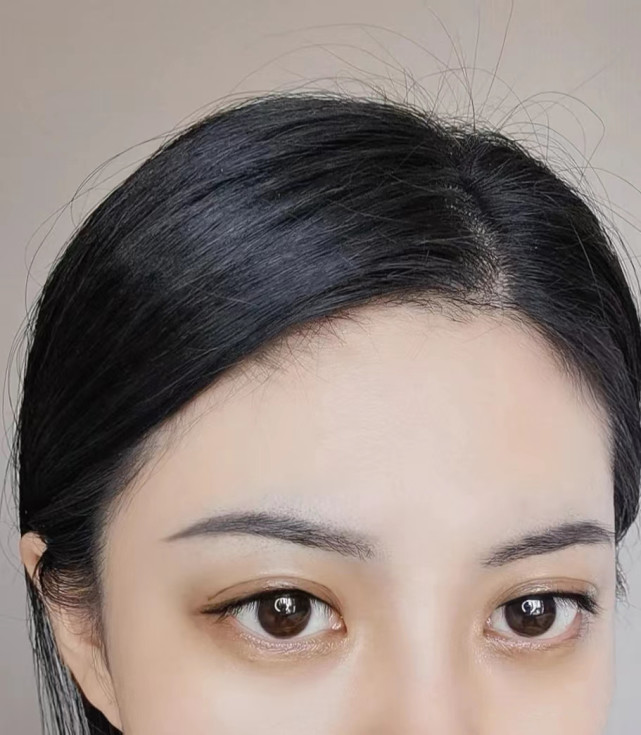 7 reasons for the swollen beauty contact lens line - iNEWS