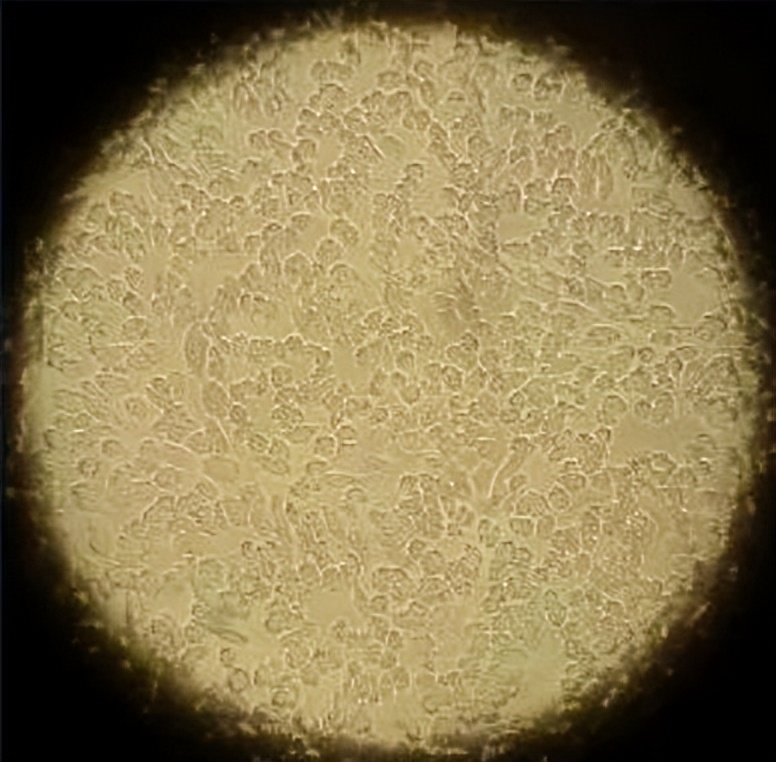 Digestive problems with adherent cells - iNEWS