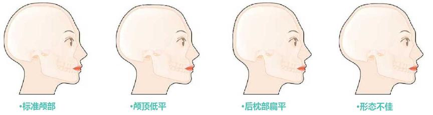 What is the high cranial top and the head covering the face? - iNEWS