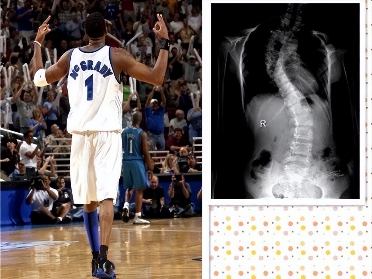 Are these players physically flawed?Wade removed his meniscus before ...