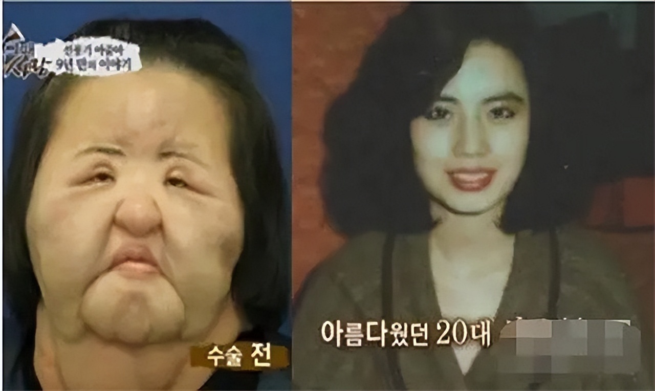 "Cosmetology Addicted" Han Huijing: Turning her face into an electric ...