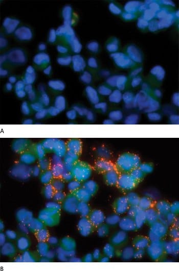 How to Create a PLA® Probe - iNEWS