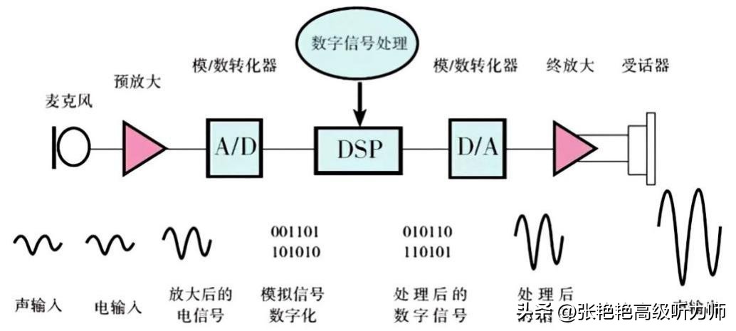 I feel that the sound of hearing aids is distorted. Is it a problem ...