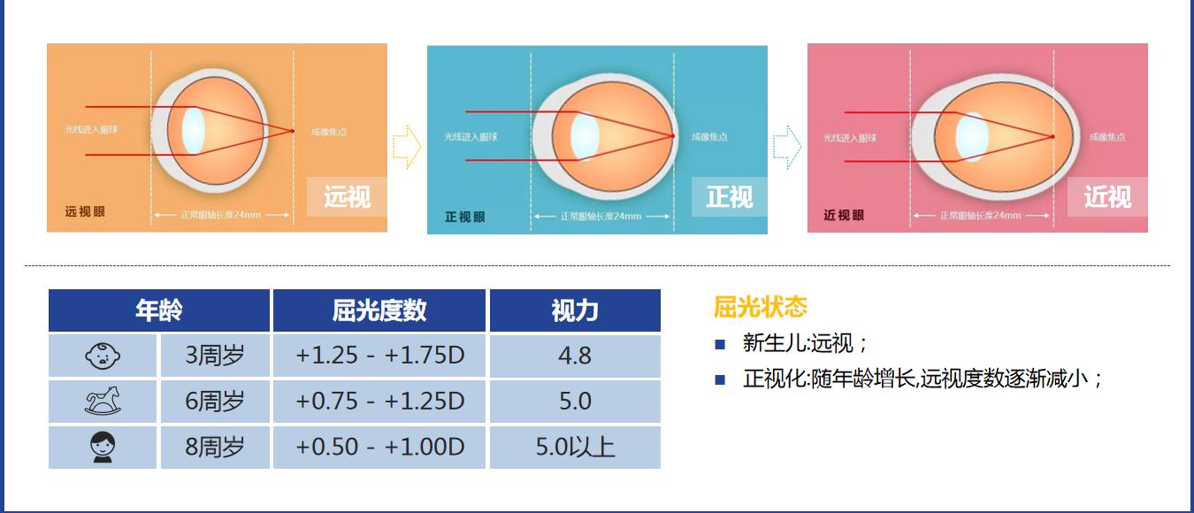What was our vision like as a child? - iNEWS