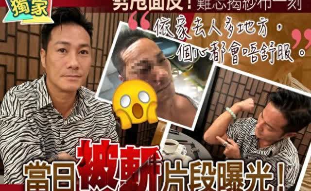 Huang Junfeng is recovering well from his injury. Thanks to Louis Koo ...