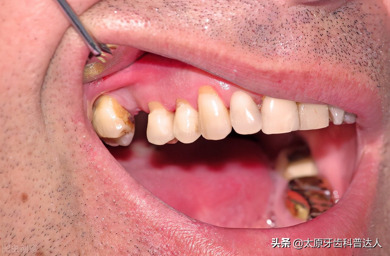 What should I do if I have a tooth defect? - iNEWS