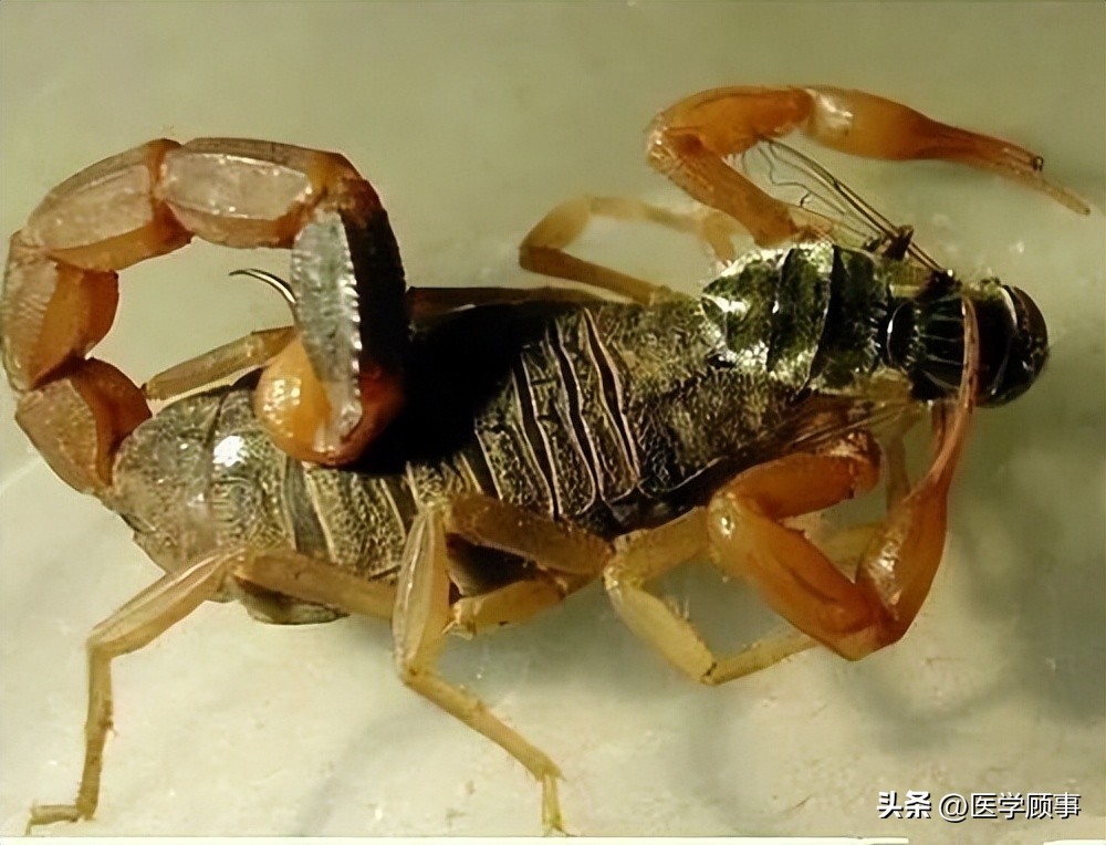 How to treat a scorpion sting correctly - iMedia