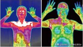 Comparison of the application and curative effect of medical infrared ...