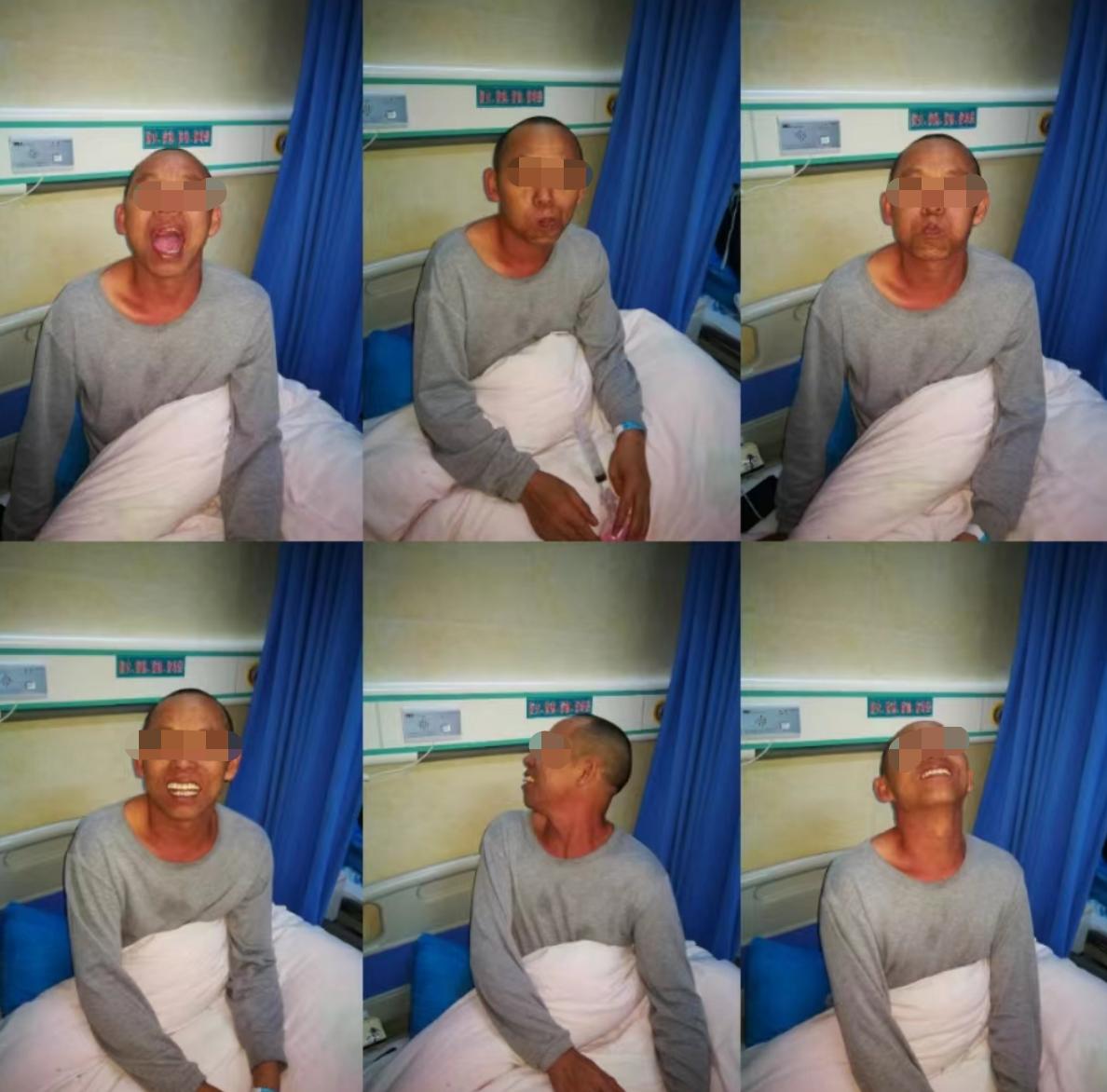 Man with stuffy nose and tinnitus actually "pulls" out nasopharyngeal ...