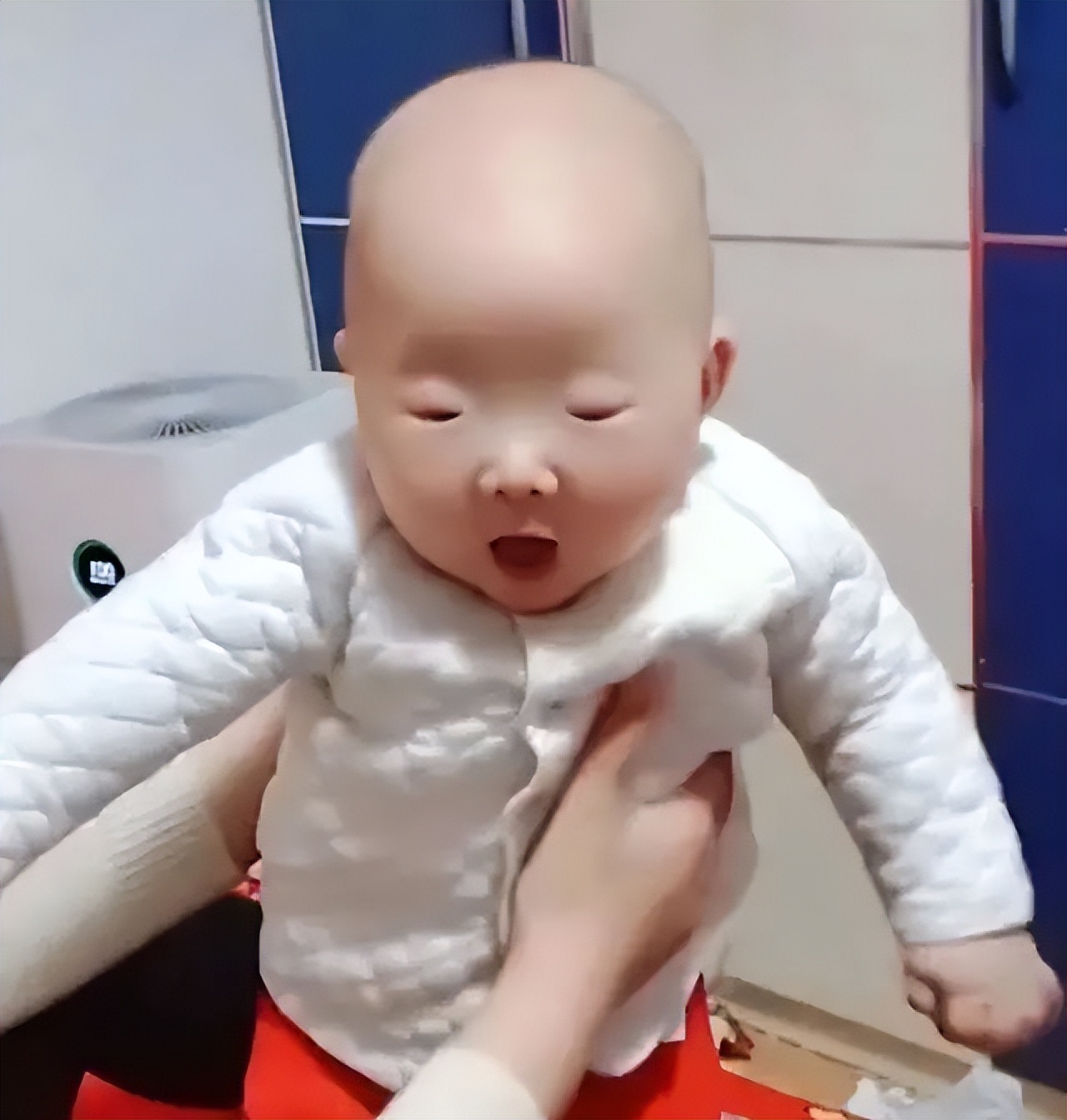 The "smallest eye" baby is on fire, and when he is awake, he is still ...