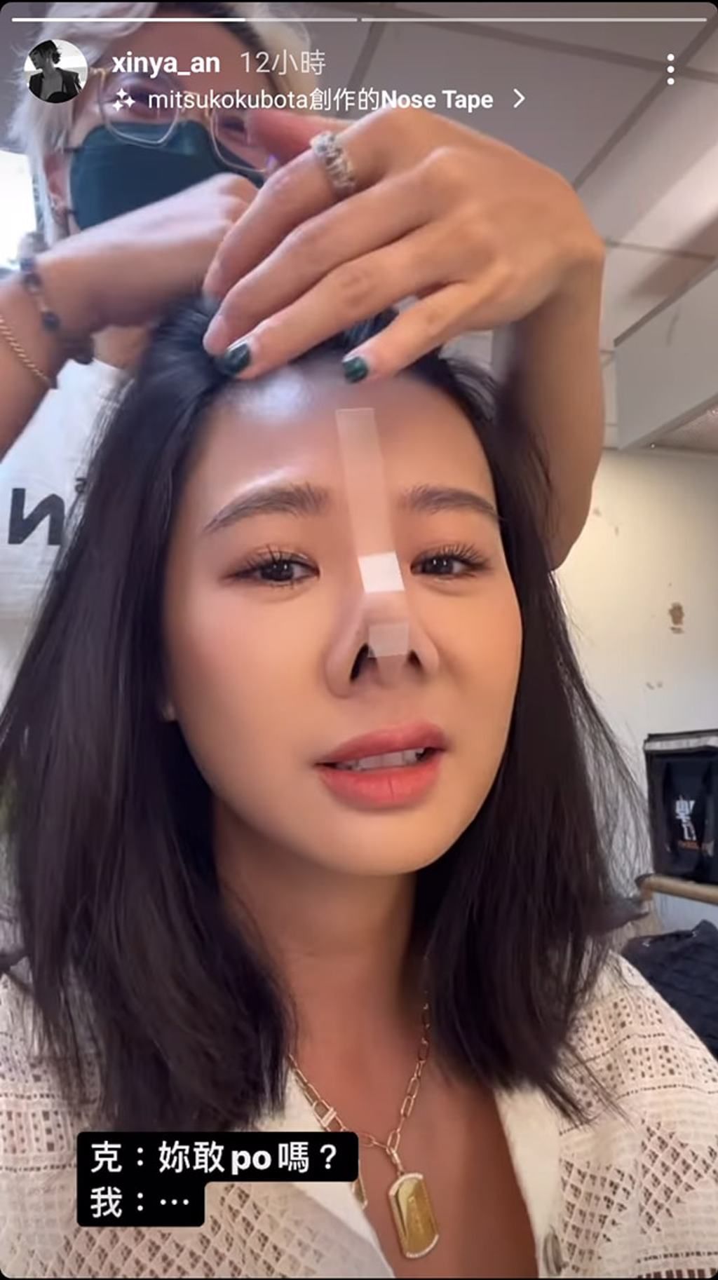 An Xinya's "Ugly Nose Deformation" was photographed and the PO network ...