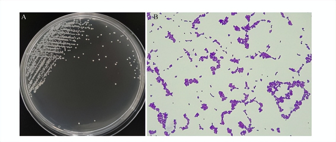 Isolation, identification, biological characteristics and whole genome ...