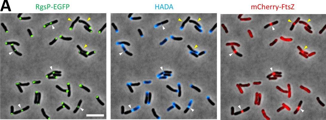 Explore the interaction between RgsP and RgsM in rhizobia growth and cell division - iNEWS