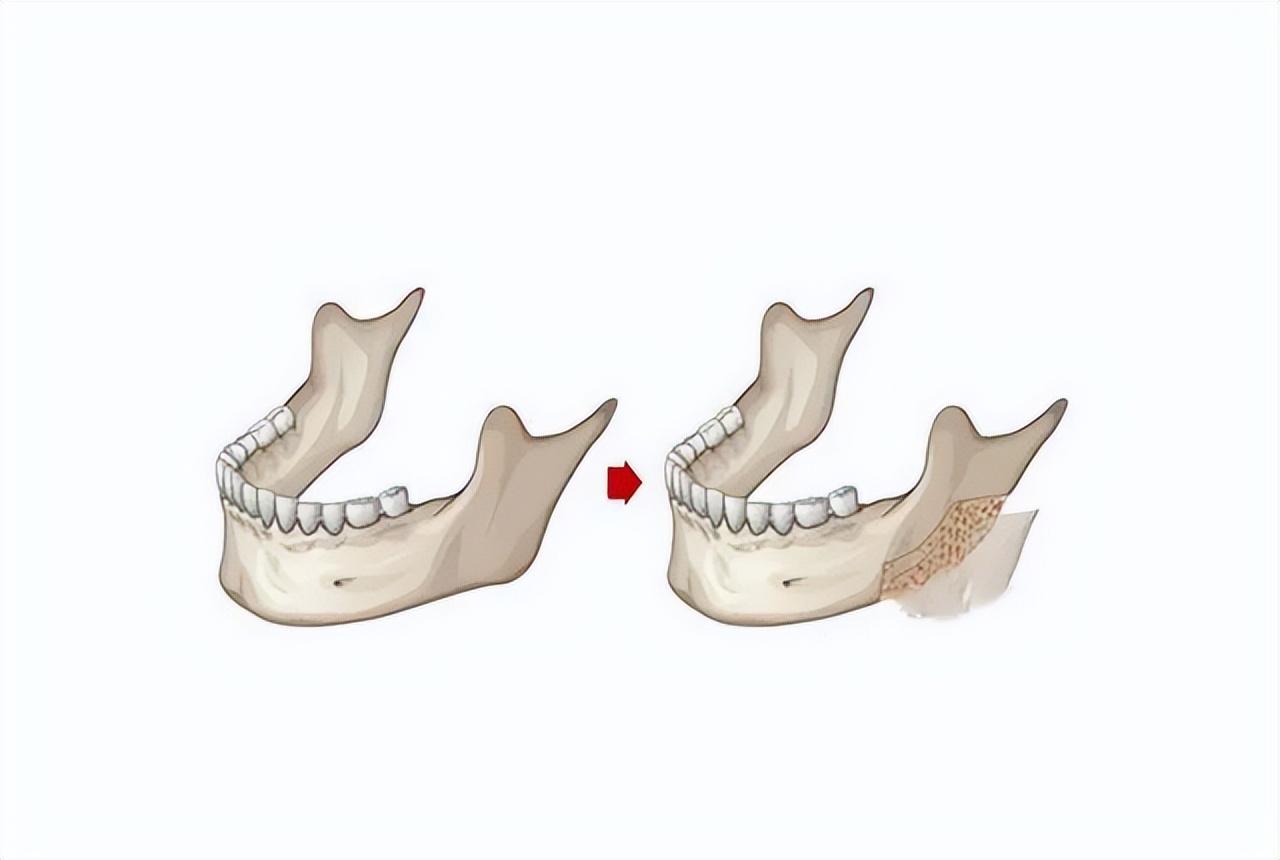 What happened to those bone-shattering actresses?There are many ...