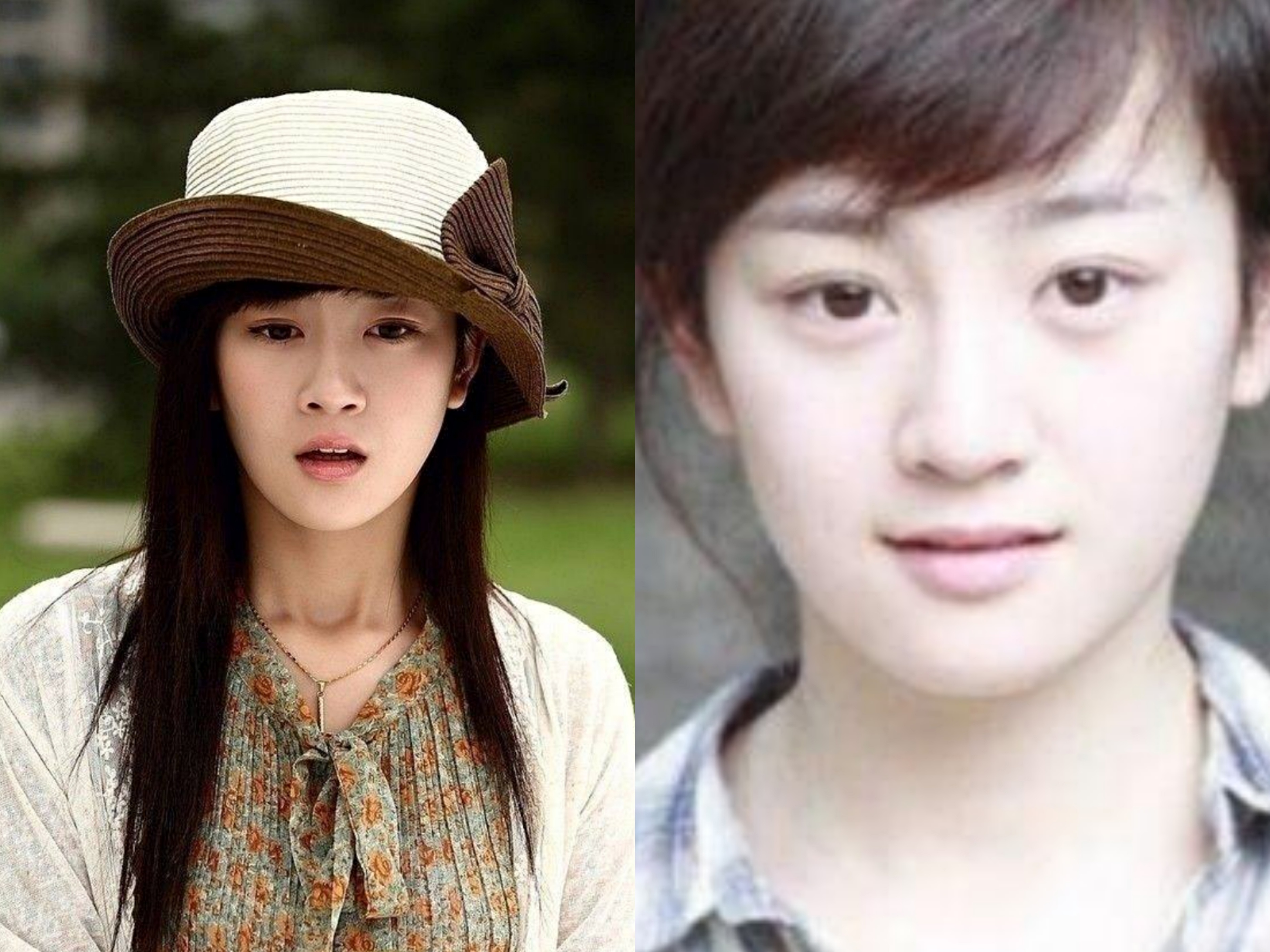 Because plastic surgery ruined their careers, changed their face beyond ...