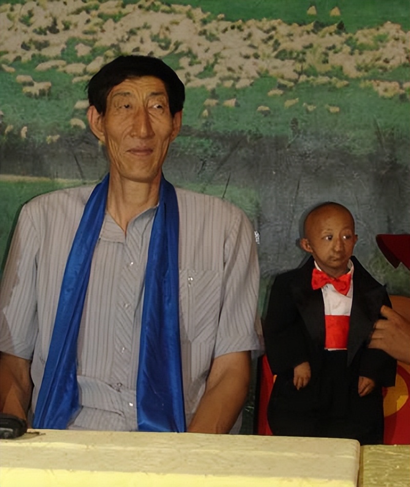 He Pingping: He became "the world's first dwarf" at the age of 19, died suddenly at the age of ...