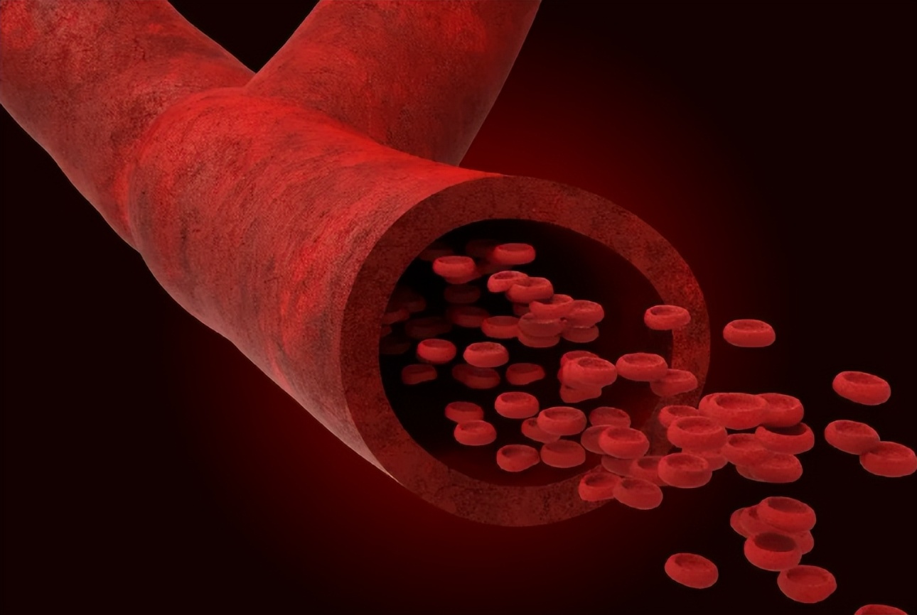 People with clean blood vessels live longer! It is recommended to do 5 ...