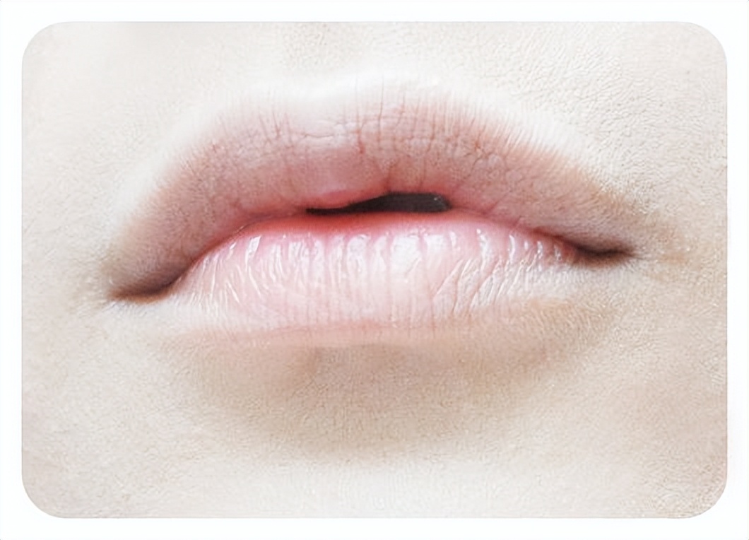 Yellow face due to stagnation of Qi, pale face due to blood deficiency ...