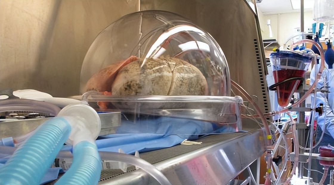 Pig brains can be resurrected, does that mean the bodies in the morgue ...