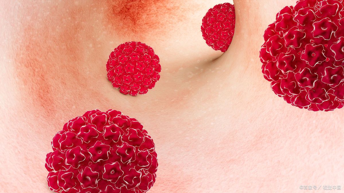 What is HPV virus and what disease can it cause? - iNEWS