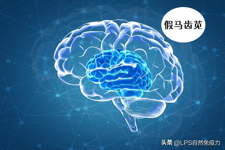 You can't say the words, do you also have a moment when your brain is ...