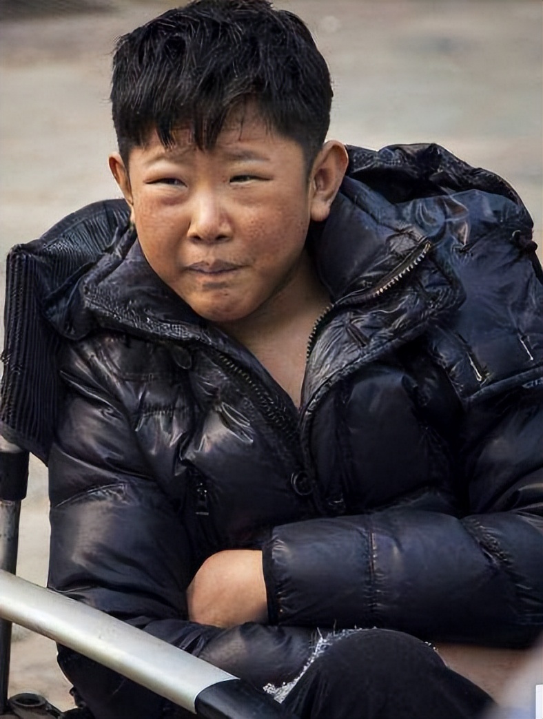 Hou Xiang: He stopped developing at the age of 9, and he can only act ...