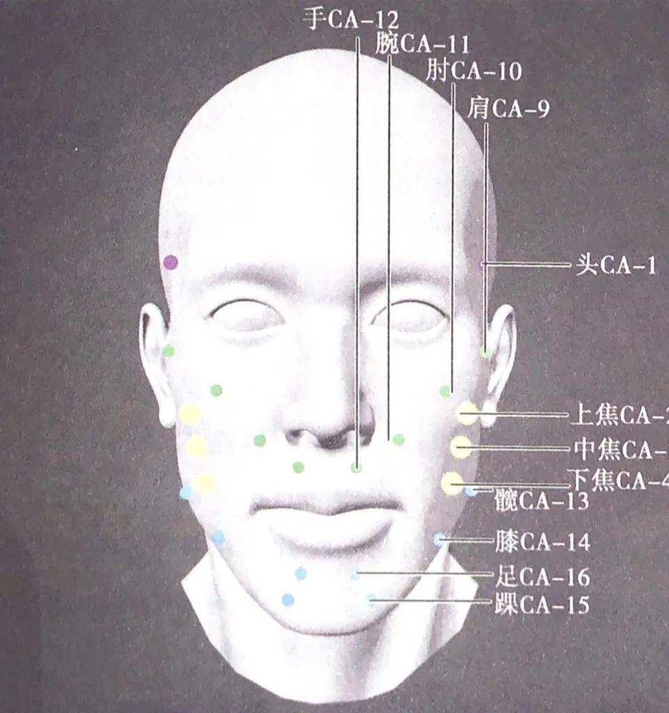 Acute and chronic pain conditioning - buccal acupuncture - iNEWS