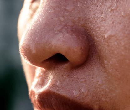 Where is the disease and where is the sweat? These kinds of abnormal ...