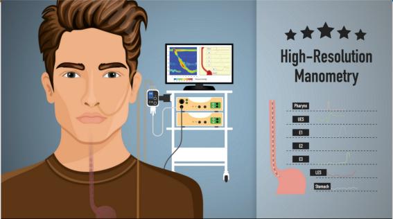 MIT Chinese researchers prepared a new type of digestive tract ...
