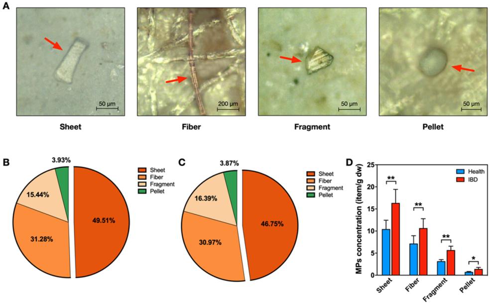 Spectral Pursuit: Microplastics Found in the Human Body? - iNEWS