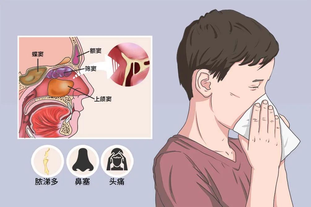 An article on children's nose-related diseases - iMedia
