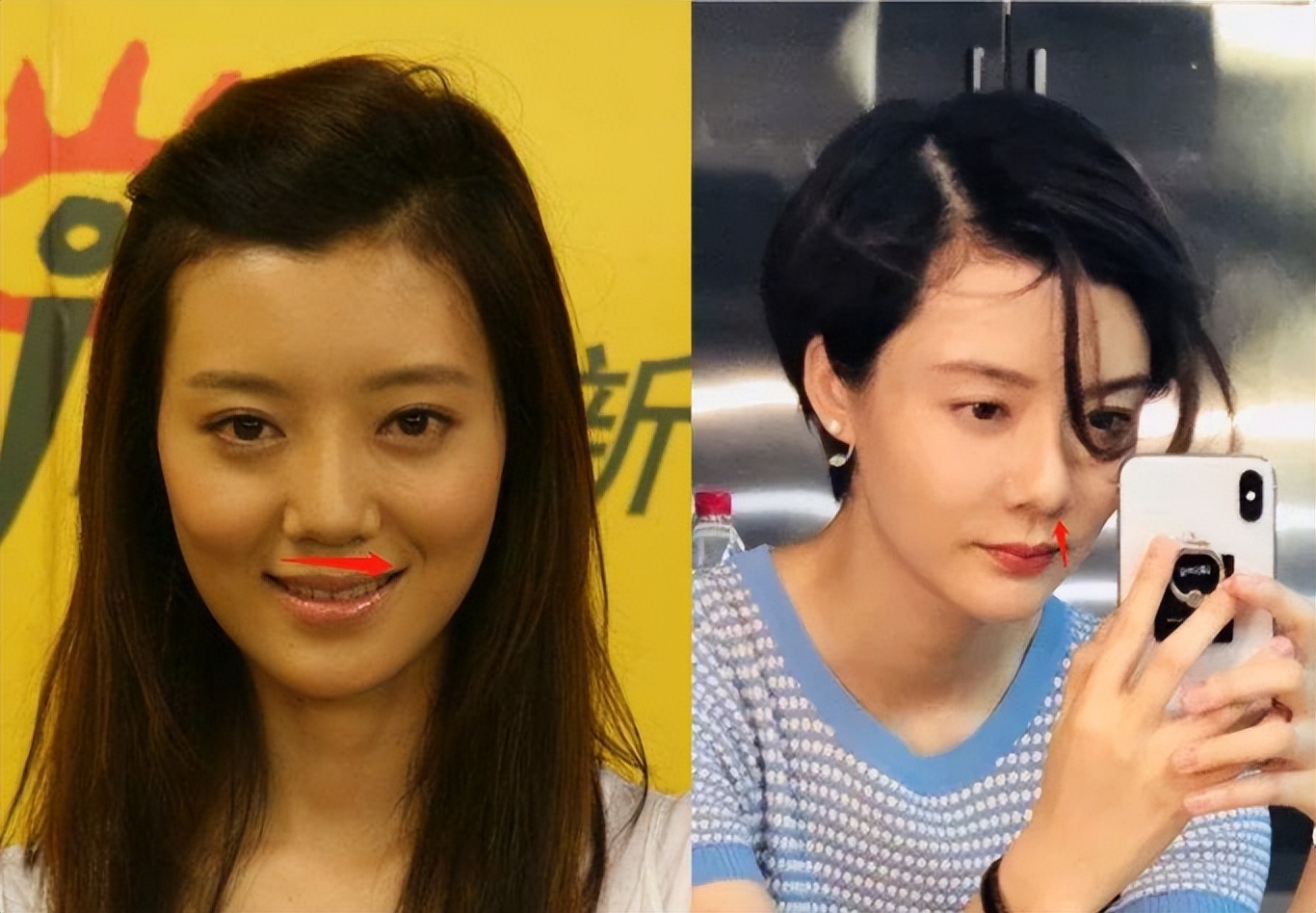 Alpine nose, awl face, cheekbones pushed inward, the stars of the ...