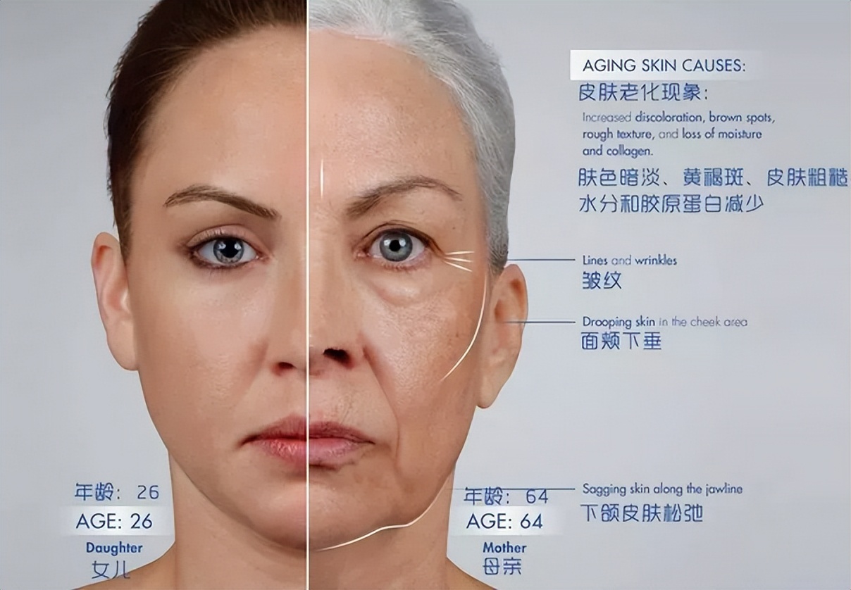 How do I know if I am suitable for wrinkle removal surgery? - iNEWS