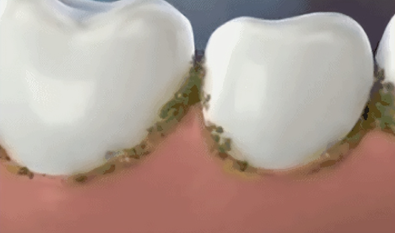 Why can't I smell something stinky from my teeth? - iNEWS