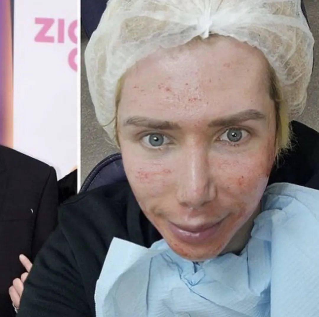 Canadian actor died on the operating table after undergoing 12 ...