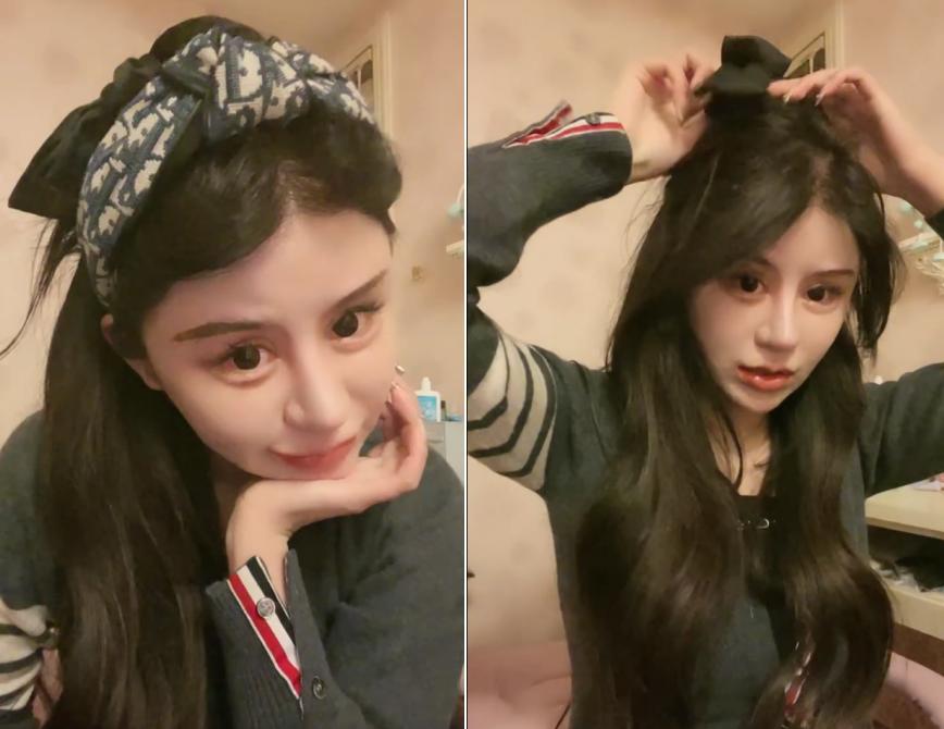 Net red Zhou Chuna spent 4 million plastic surgery!After five years of ...