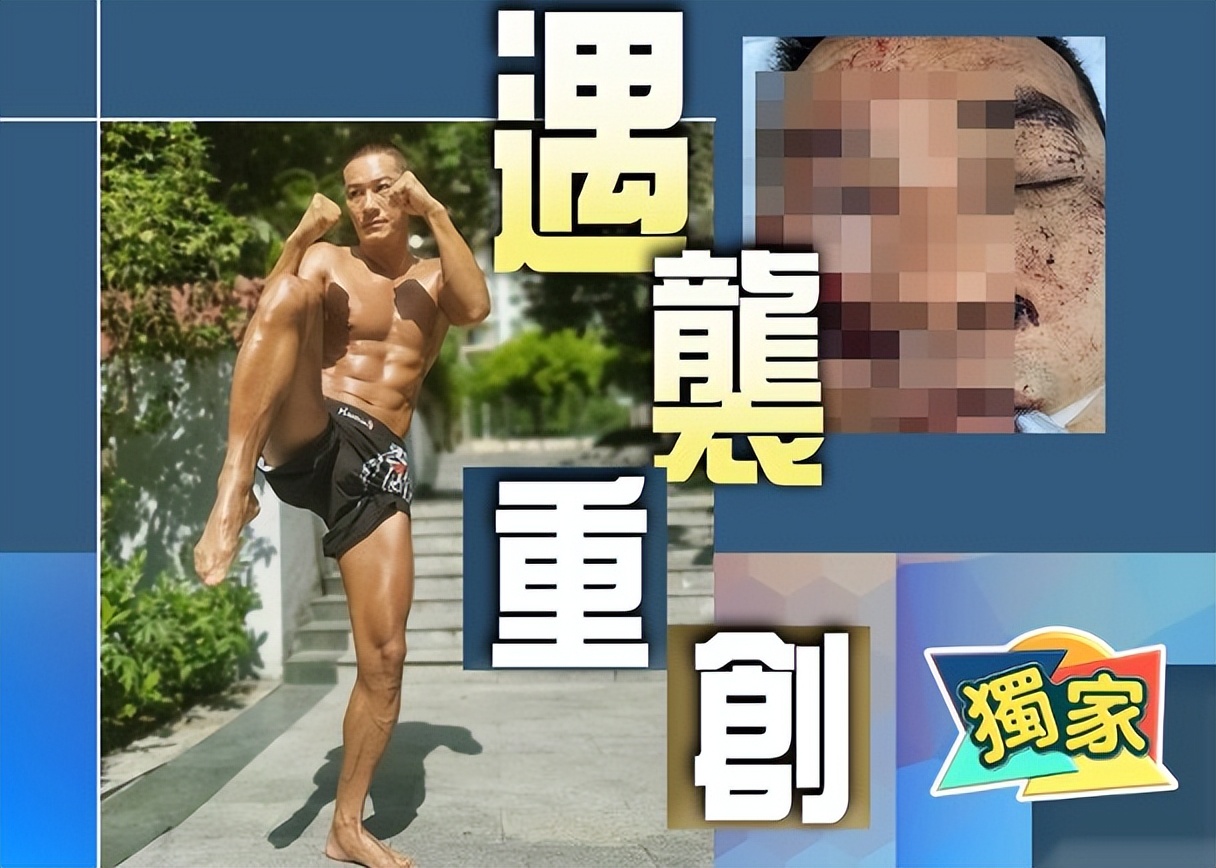 Hong Kong star Huang Junfeng was attacked and slashed three times, and ...