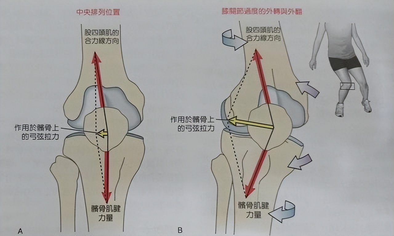 The largest and most powerful muscle in the human body - the quadriceps ...